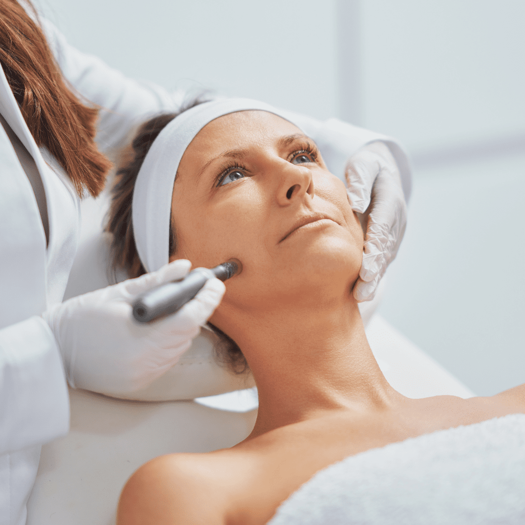Skin Needling